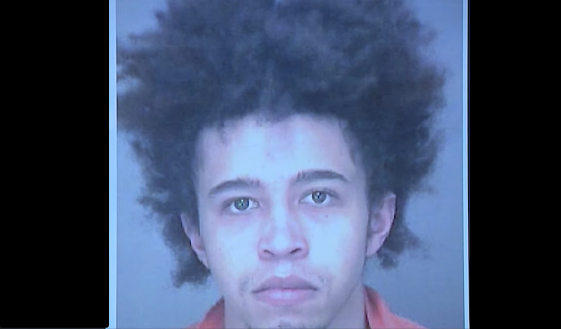 Parasite: How a Wellness Coach's Eye Nightmare Sparked a Viral TikTok ...